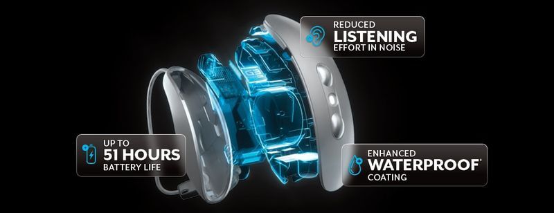 Starkey Omega AI from a Best Practices Audiologist